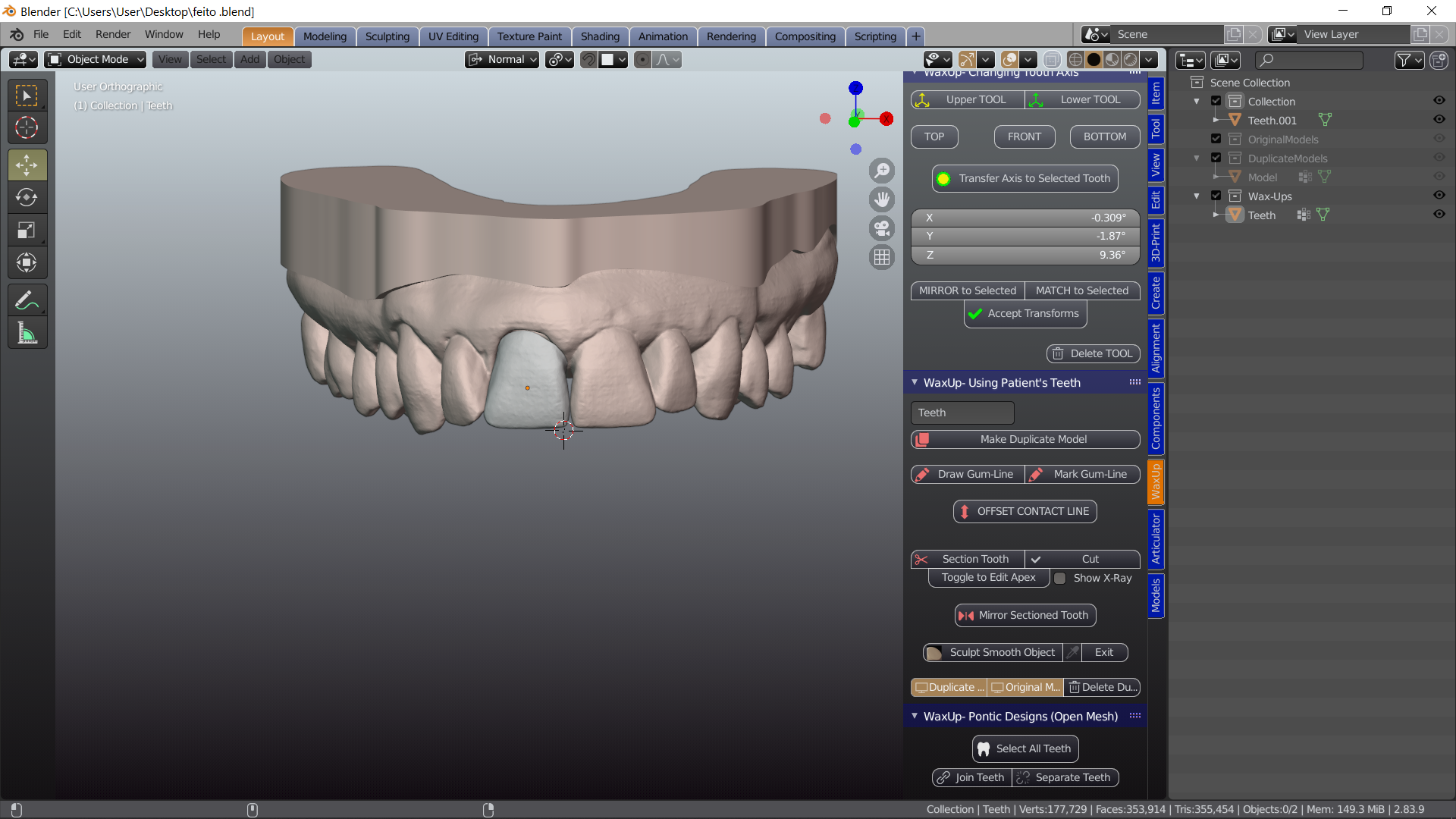 index antiga – 3D Dentistry, Odontologia Digital